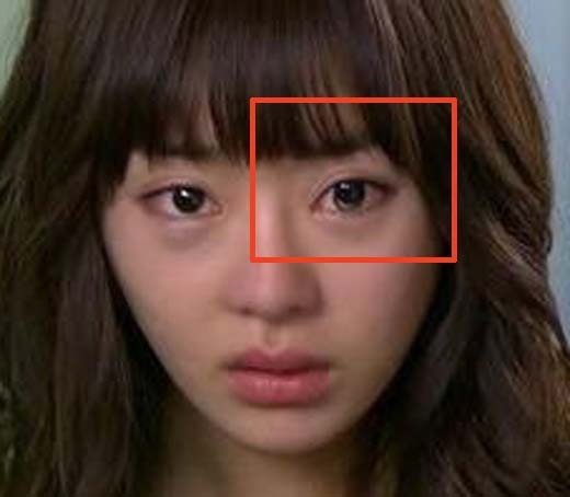 대전안과대전라섹수술 써클렌즈 당신의 눈이 위험하다 연예인 눈이서클렌즈 예쁘다고 무조건 착용하는것은 금물 네이버 블로그