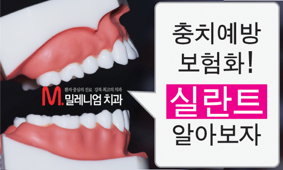 실란트 충치예방 치과 보험진료 치아홈메우기 치면열구전색 네이버 블로그
