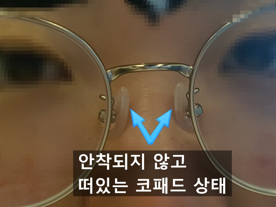 안경피팅 흘러내림 머리눌림 해결하기 네이버 블로그
