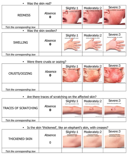 원주 아토피피부염 : 네이버 블로그